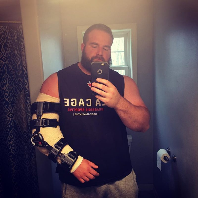 Road to Recovery: Training Post-Surgery | Strongman Spenser Remick
